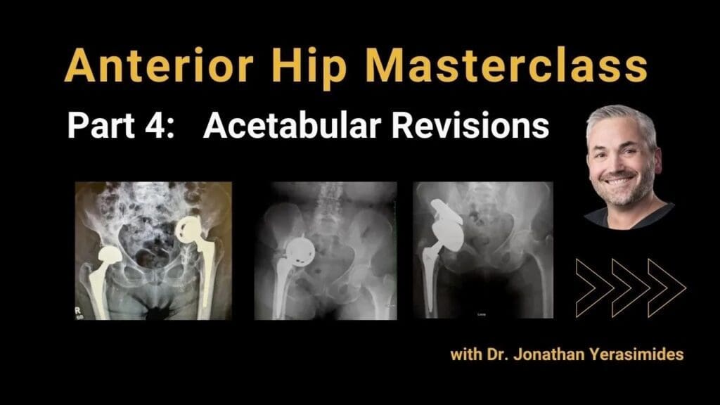 Masterclass Part One: Introduction to Anterior Approach Hip Replacement ... Masterclass Part One: Introduction to Anterior Approach Hip Replacement ...